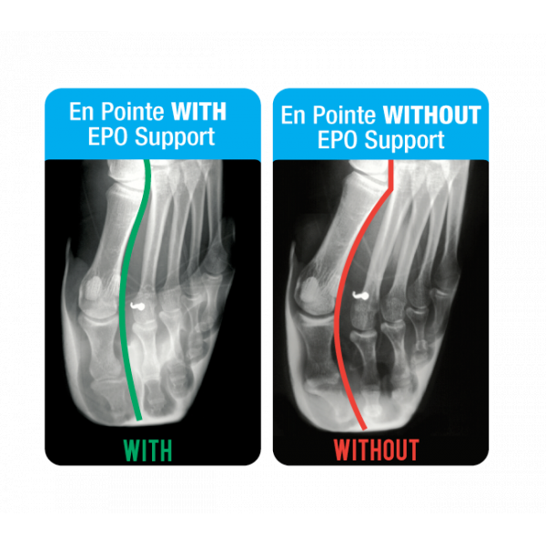 En Pointe Orthotics | Safe - Simple - Smart